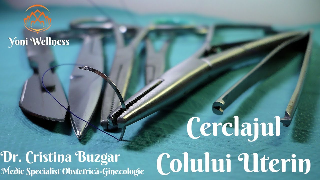 S1.Ep16: Cerclajul colului uterin | Când şi cum trebuie cusut colul ...