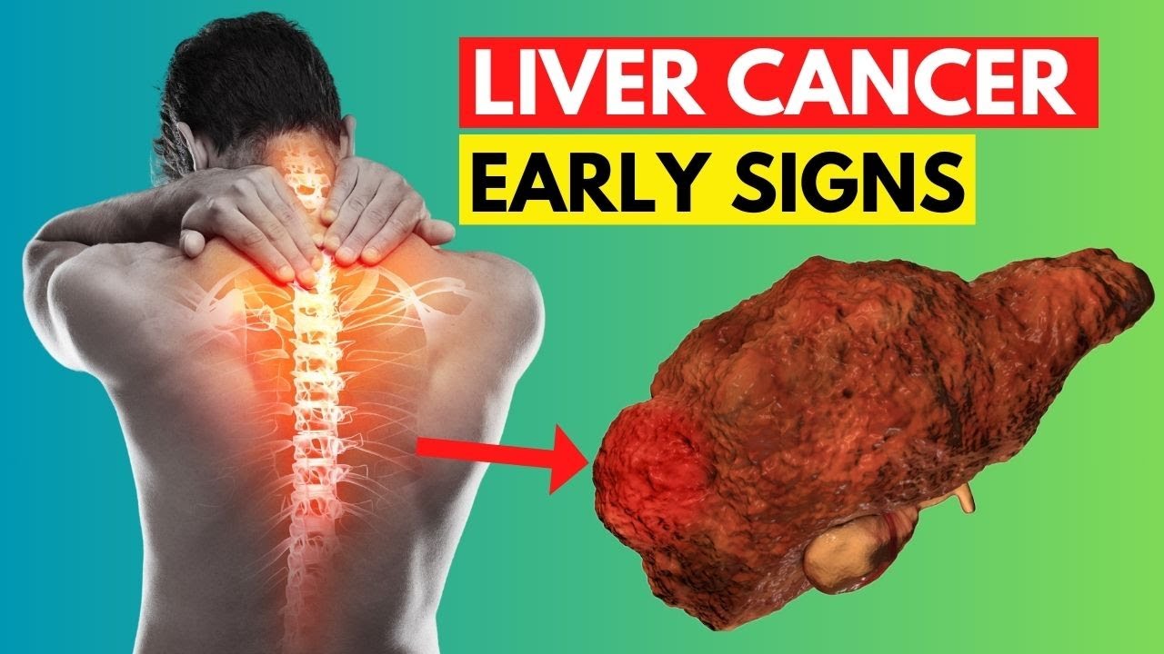 Liver Cancer Symptoms In Women Ovarian Cancer: Symptoms, Diagnosis
