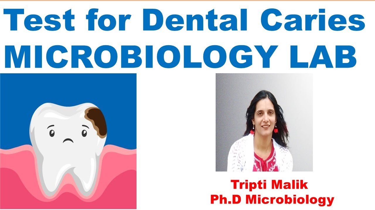 Dental Caries Microbiology | Synder's Test Agar| Microbiology ...