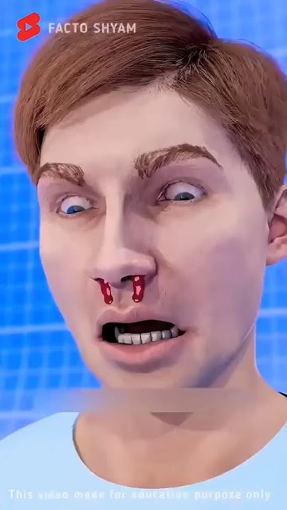 What To Do When You Get a Nosebleed - YouTube
