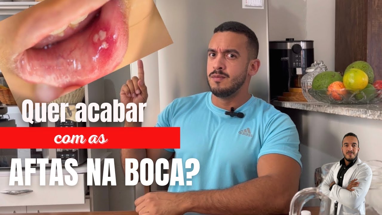 Aftas na boca! Como surgem e como acabar? - YouTube