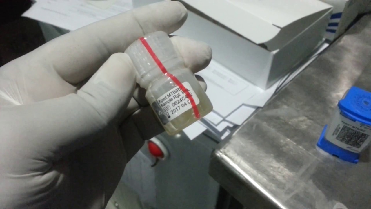 Gene xpert - YouTube