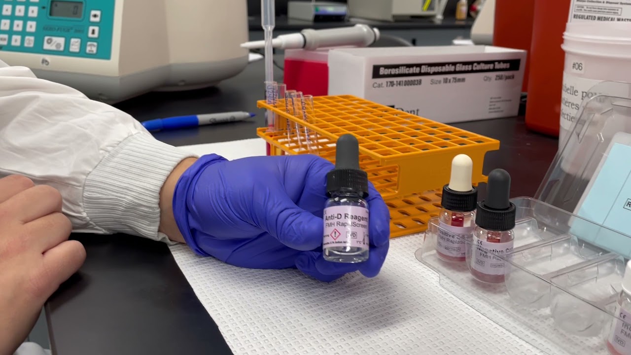 Test de la rosette immune partie 1 - YouTube