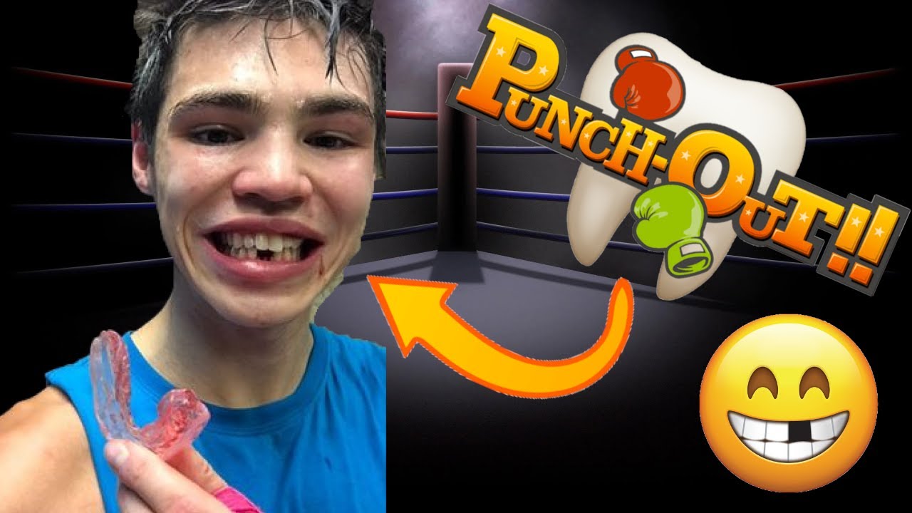 I got my teeth punched out - YouTube