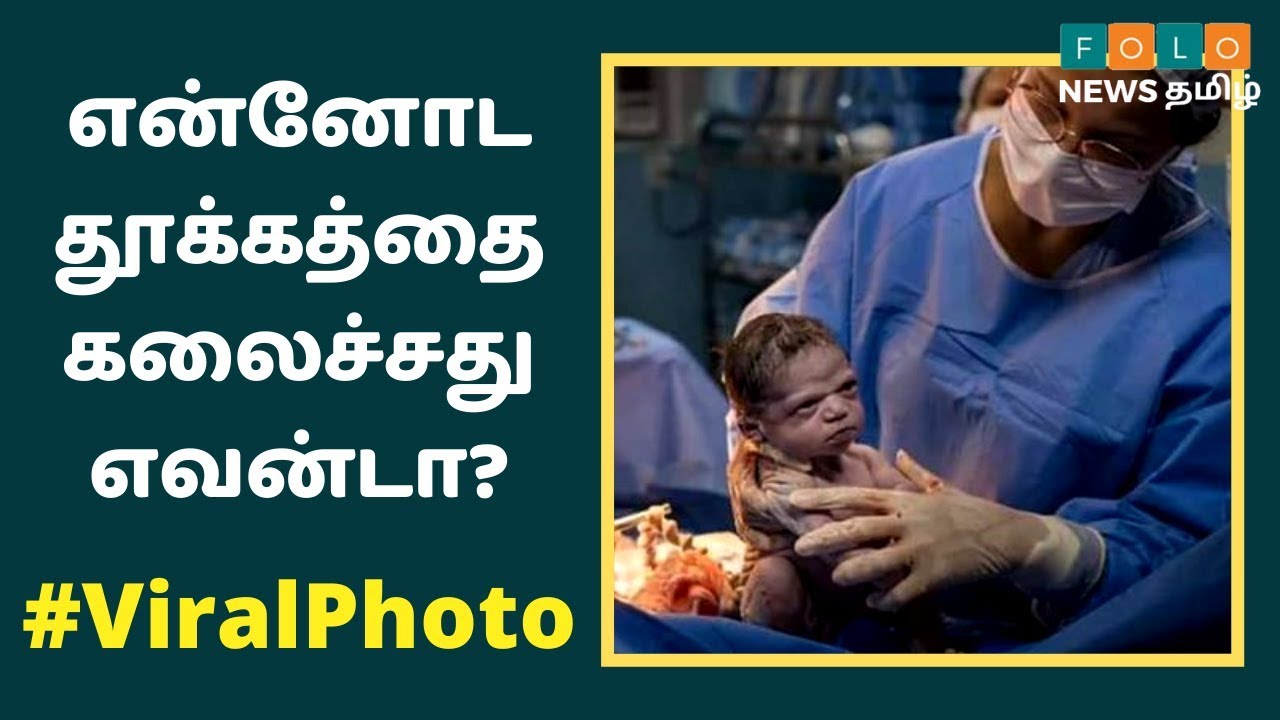 ஏன்டா எழுப்பி விட்டீங்க - புதிதாக பிறந்த குழந்தையின் கோபம் | New Born ...