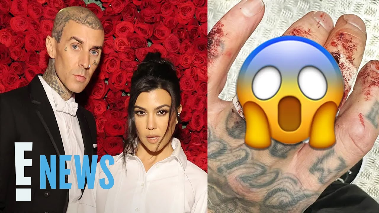 Travis Barker Reveals a GRUESOME Hand Injury | E! News - YouTube