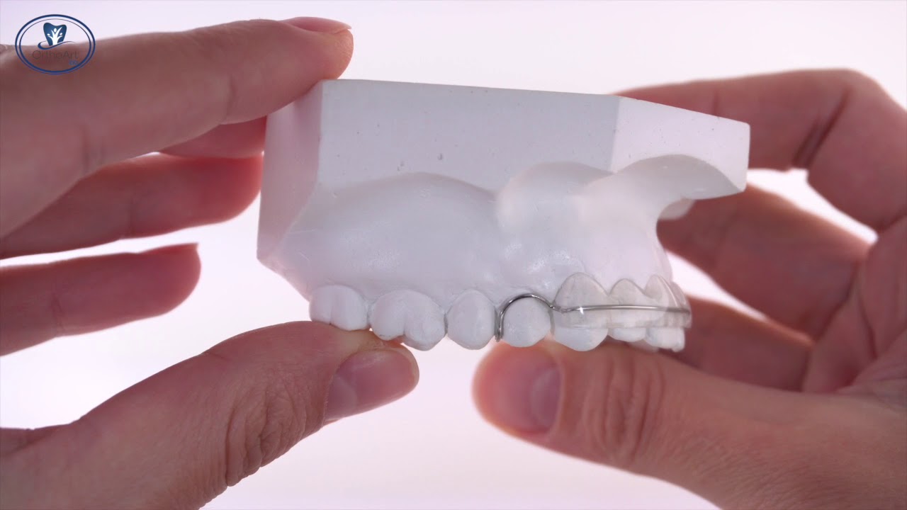 Spring Aligner - YouTube
