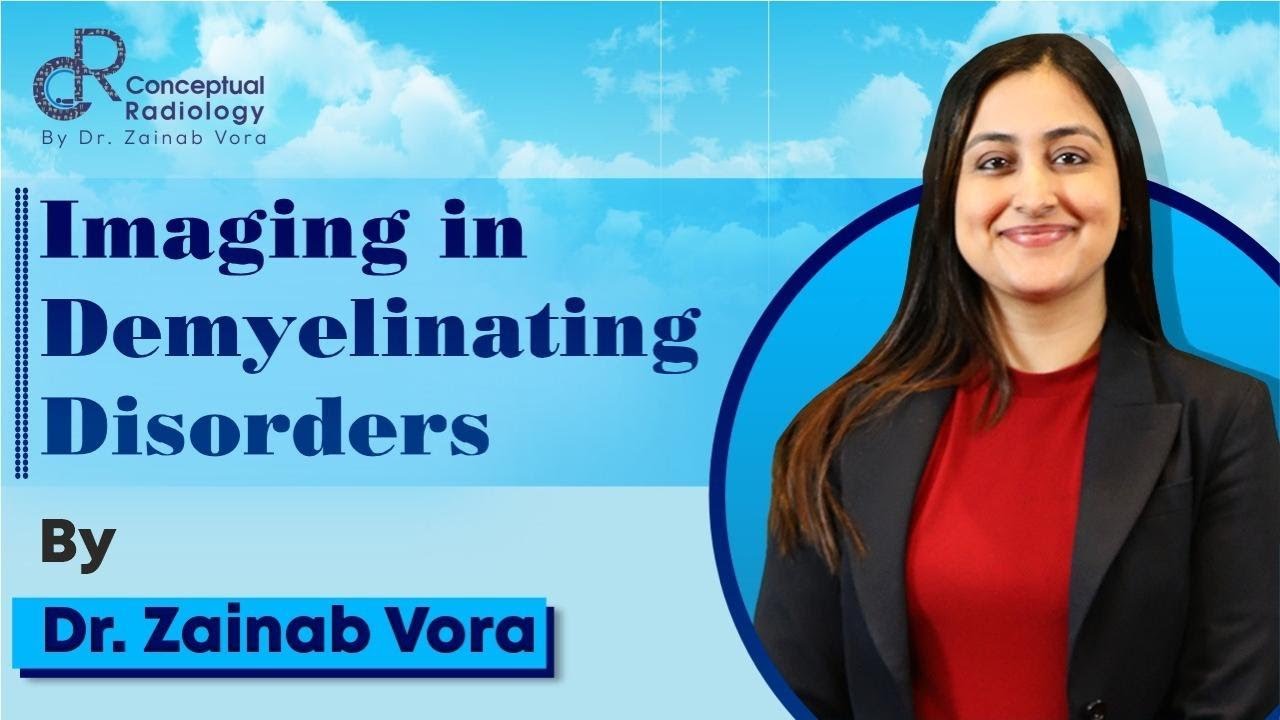 Imaging in Demyelinating Disorders by Dr.Zainab Vora ...