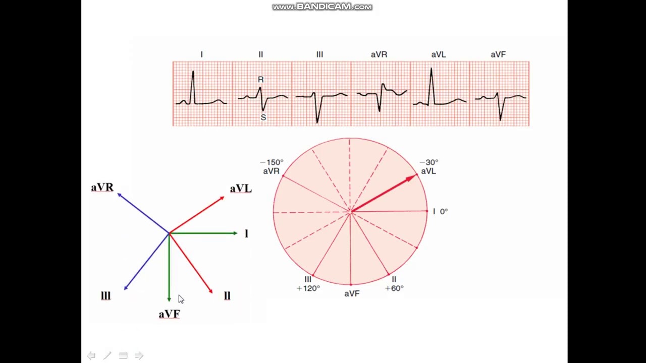 Axis Calculation by equiphasic method - YouTube