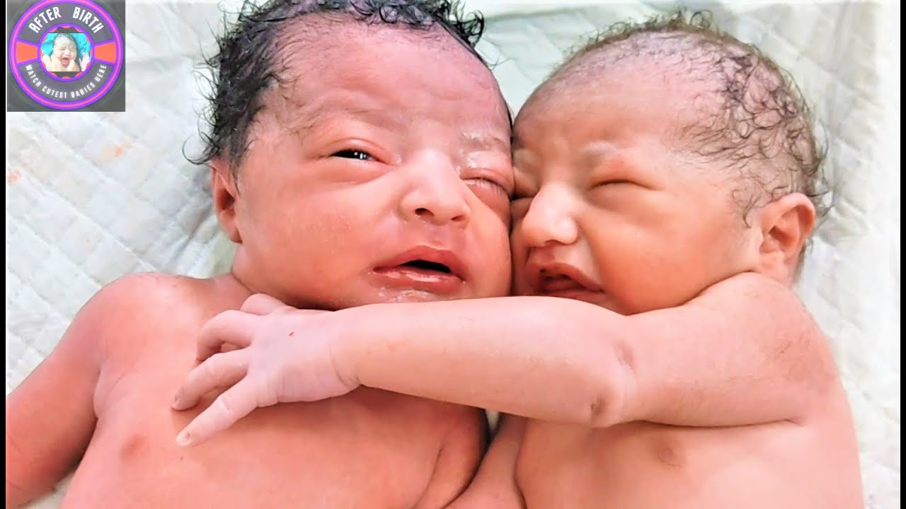 Twin newborn babies first cry after delivery || Looks adorable in Dress ...