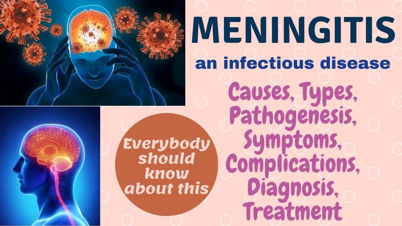 Meningitis disease | Causes, Types, Pathogenesis, Symptoms ...
