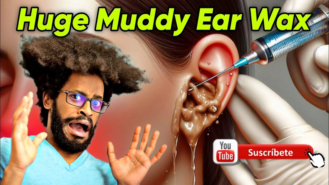 Huge Muddy Ear Wax #earwaxremoval #earwax - YouTube