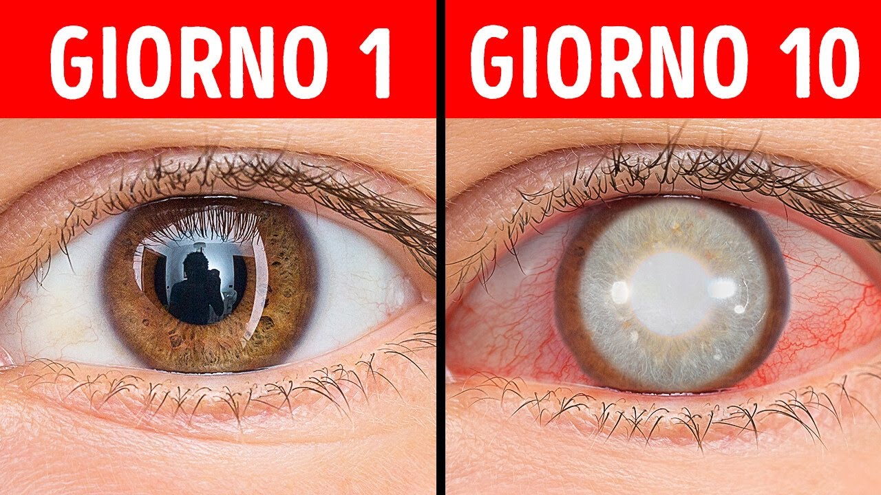 Cosa Succede Se Non Sbatti Le Palpebre? - YouTube