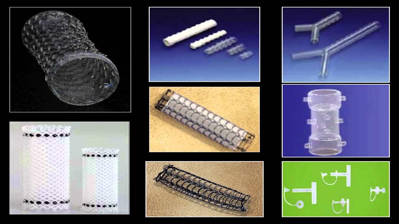 GTSC 2013 Daniel Sterman Management of Airway Stenosis - YouTube
