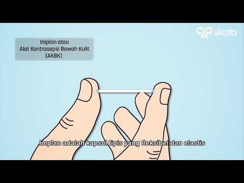 Alat Kontrasepsi KB MKJP IMPLAN - YouTube