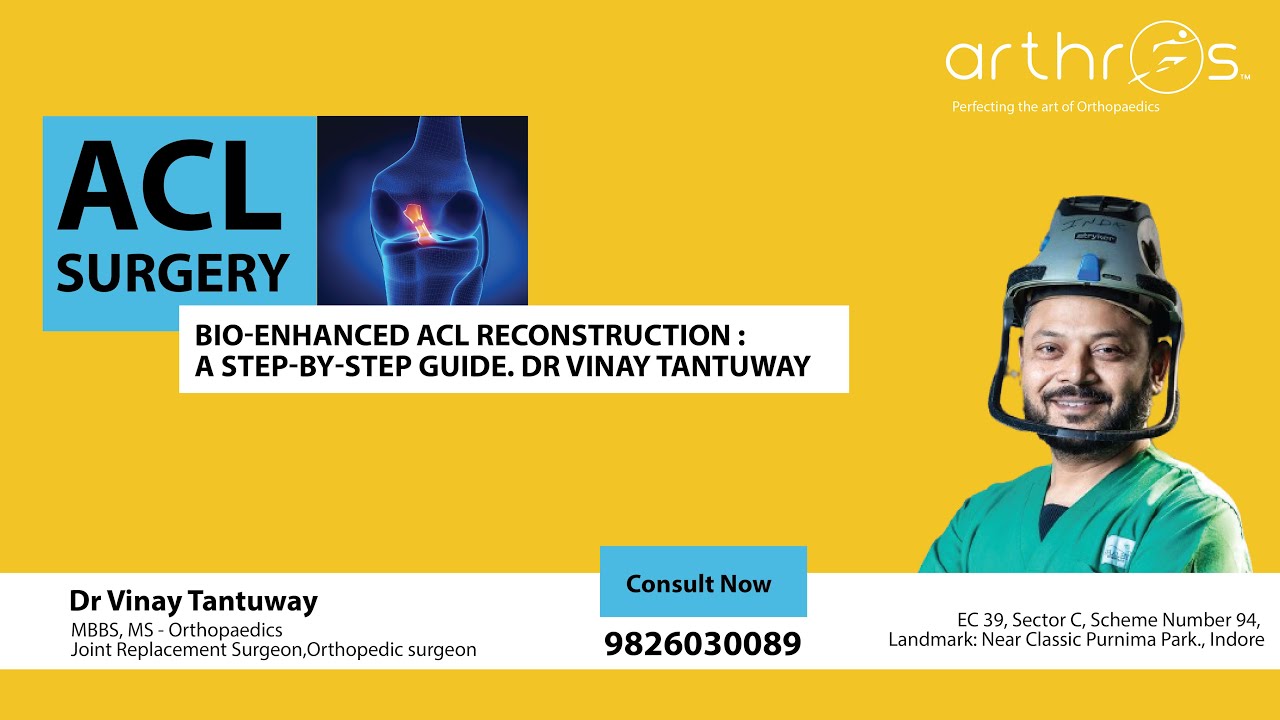 Bio-Enhanced ACL Reconstruction: A Step-by-Step Guide.Dr Vinay Tantuway ...