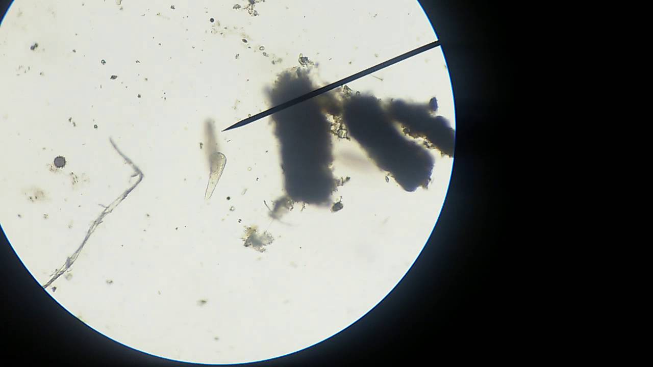 Living Planaria & Paramecium under microscope. - YouTube