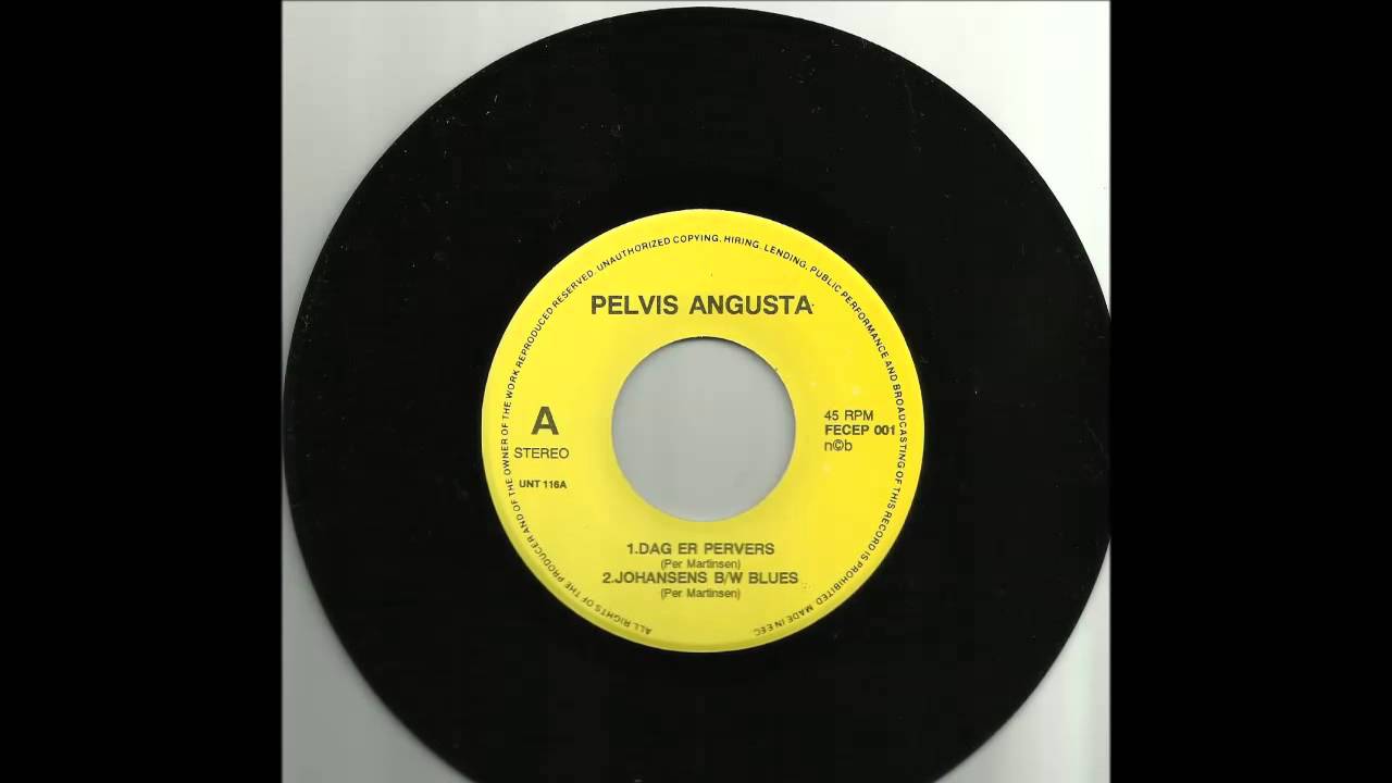 Pelvis Angusta - YouTube