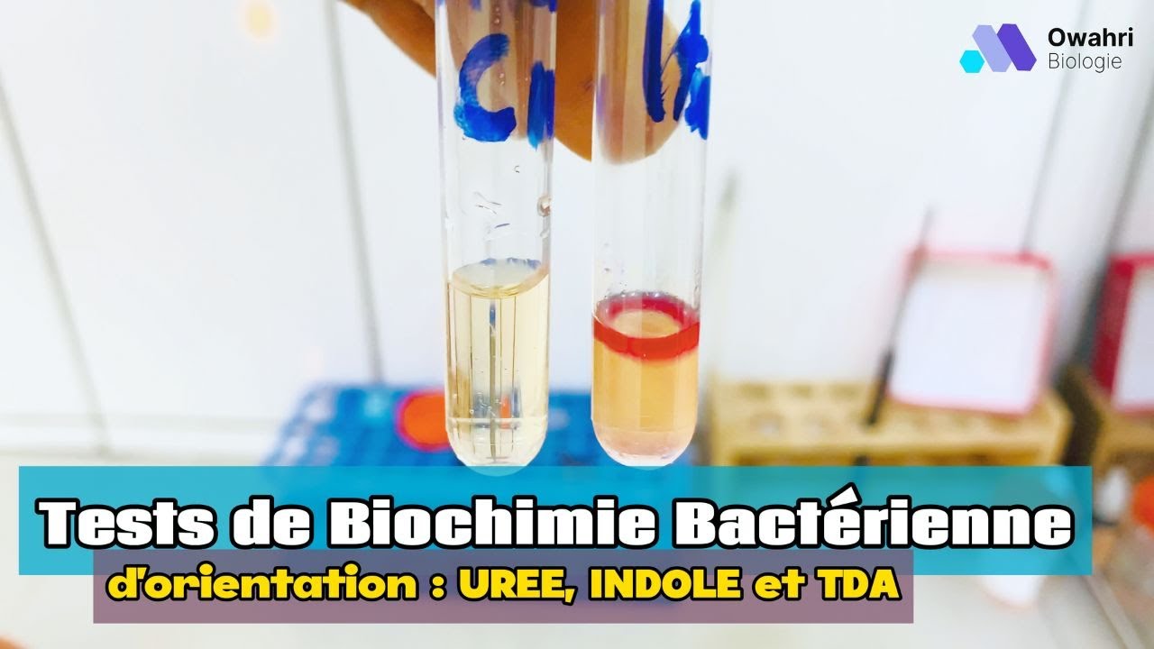Tests Biochimiques d'Orientation en Bactériologie : Urée, Indole et TDA ...
