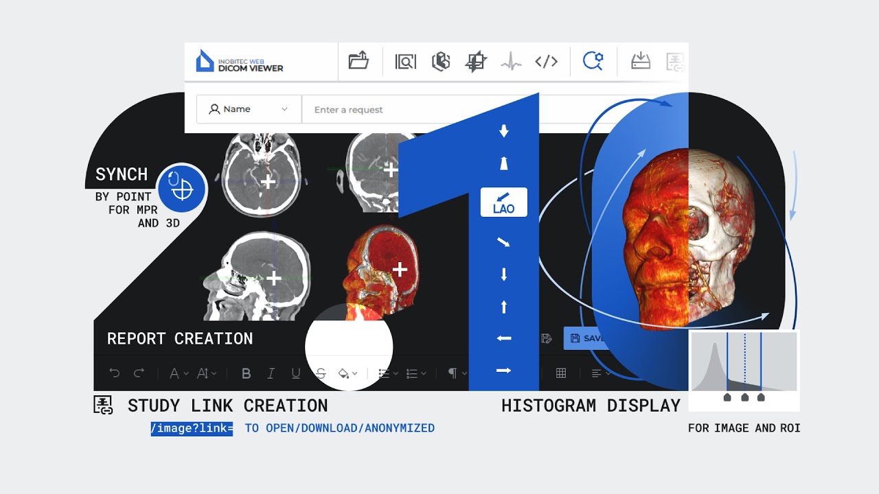 New features of Inobitec Web DICOM Viewer 2.10 - YouTube