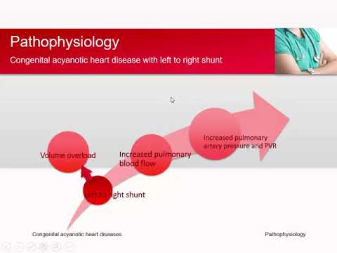 Dr. alaa roshdy congenital acyanotic heart disease - YouTube