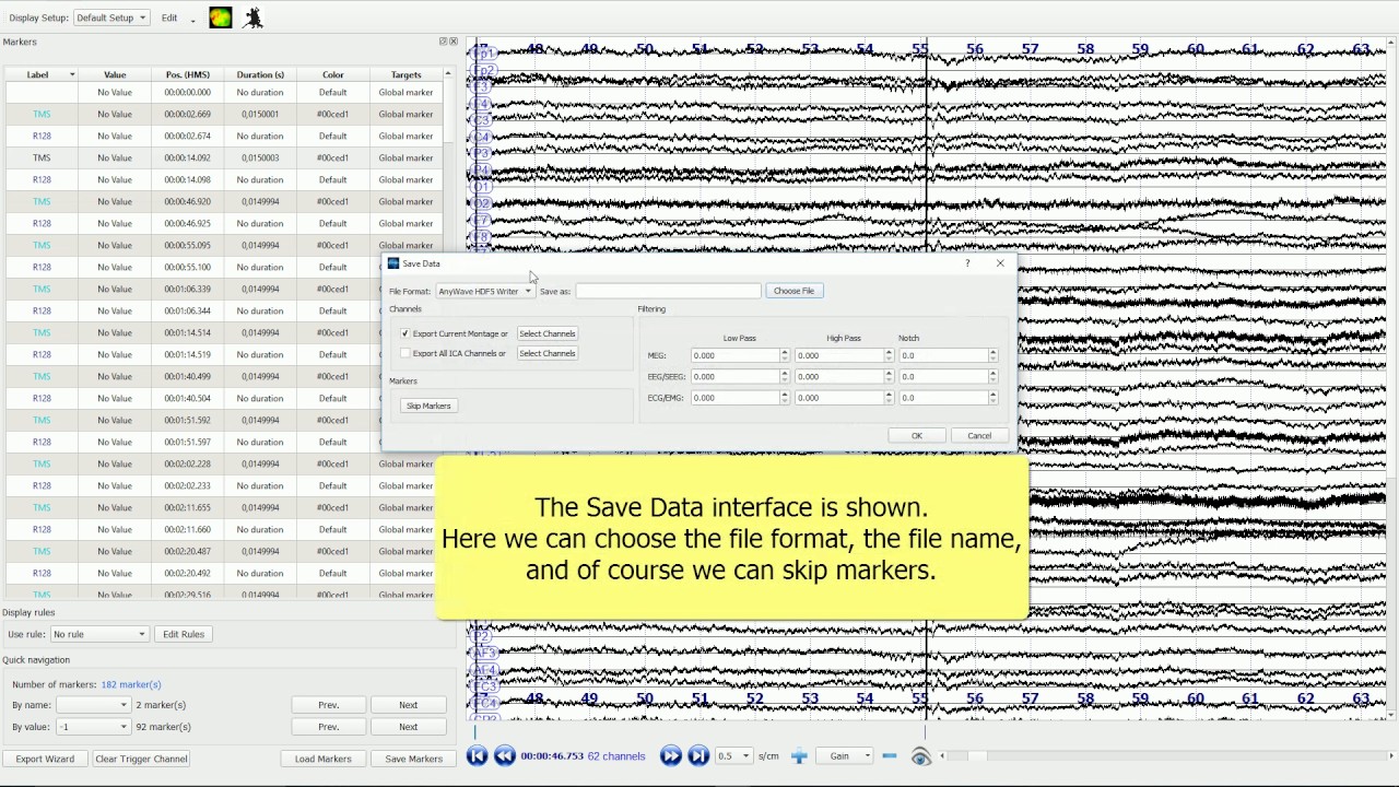 Cutting data around TMS Simulations - YouTube