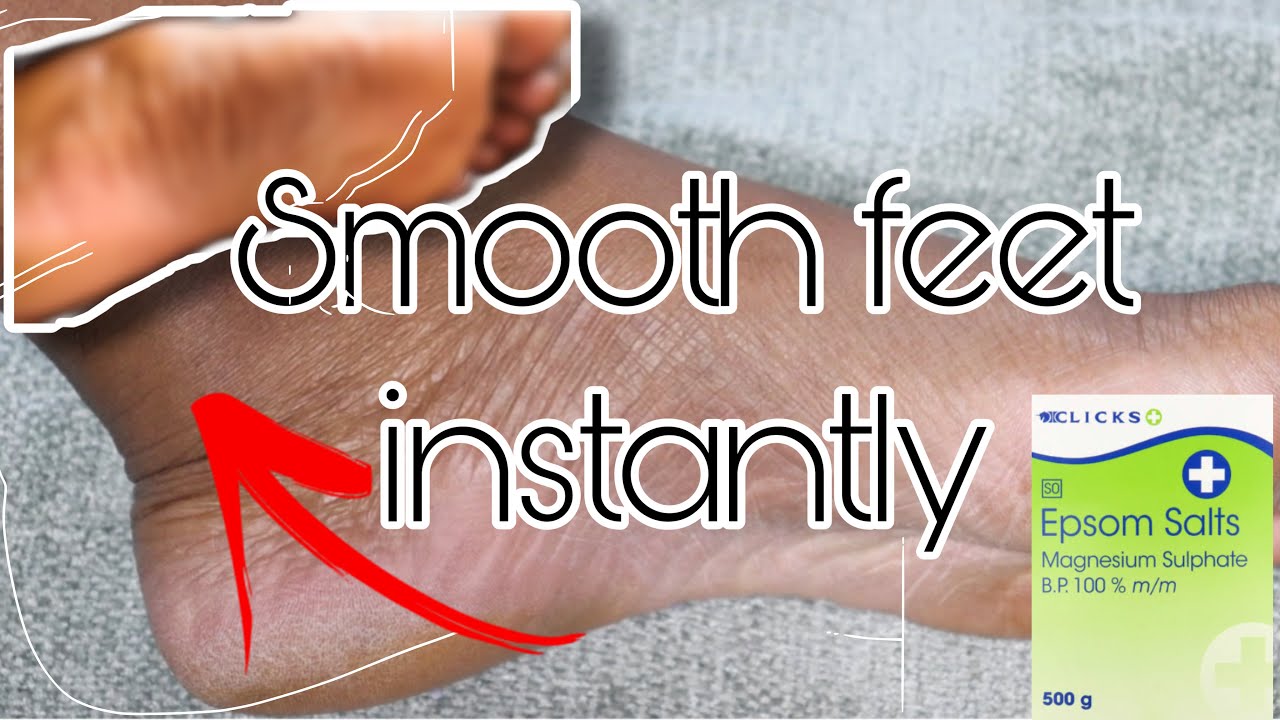 HOW TO HAVE SMOOTH FEET NATURALLY AT HOME *INSTANT RESULTS* - YouTube