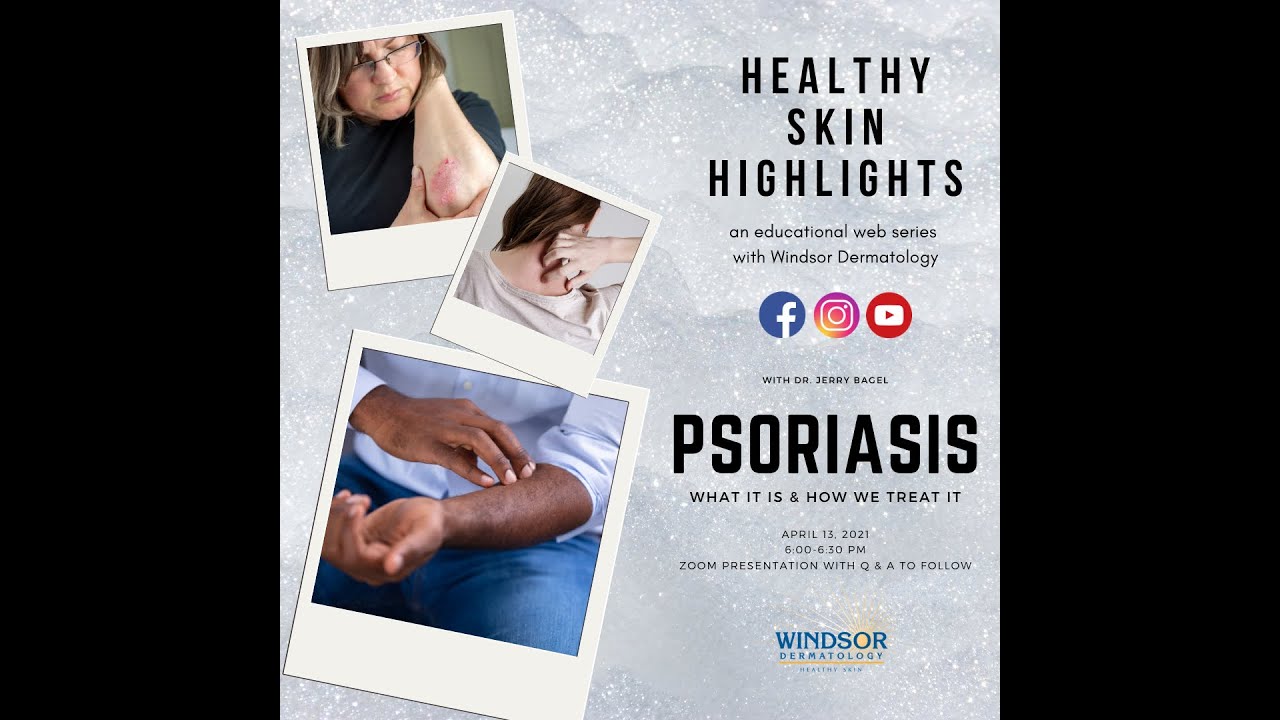 Healthy Skin Highlights: Psoriasis with Dr. Jerry Bagel - YouTube