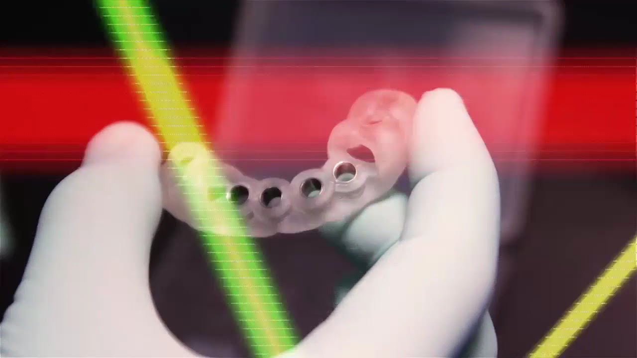 Cirugía guiada GMI Frontier - Ecuador - YouTube