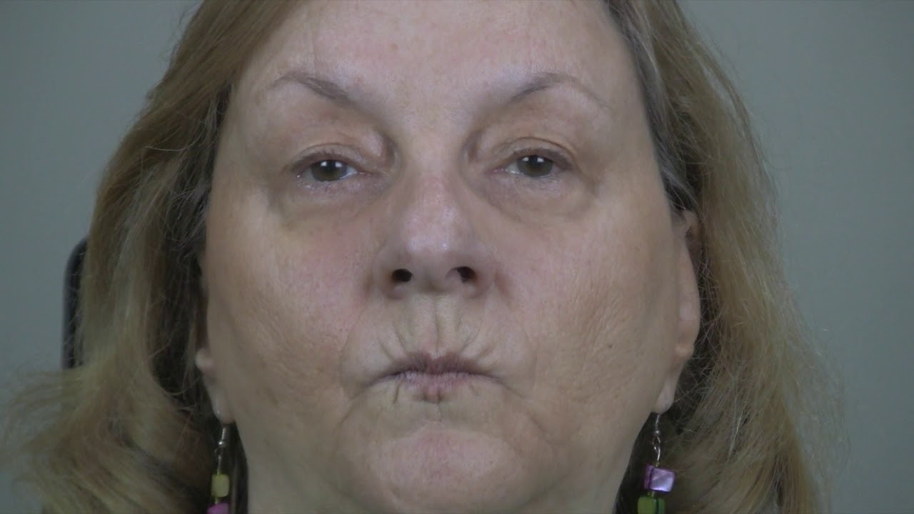 Botox for the Treatment of Blepharospasm - YouTube