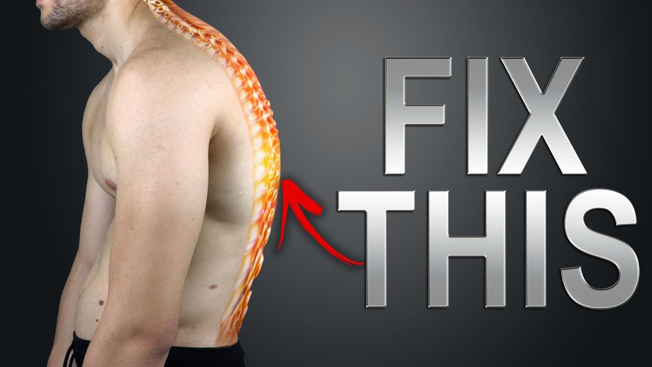FIX THIS. BEFORE IT’S TOO LATE. Stop Rounded Posture - YouTube