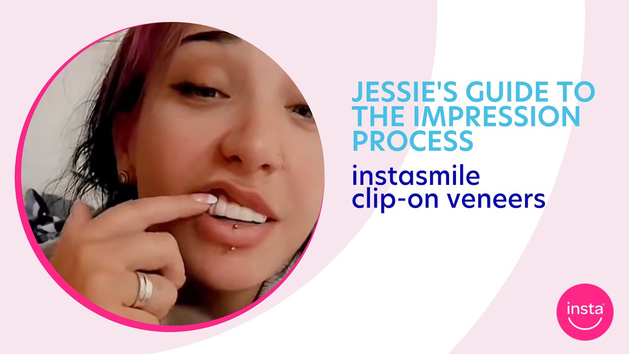 Jessie A guide to the instasmile impression process - YouTube
