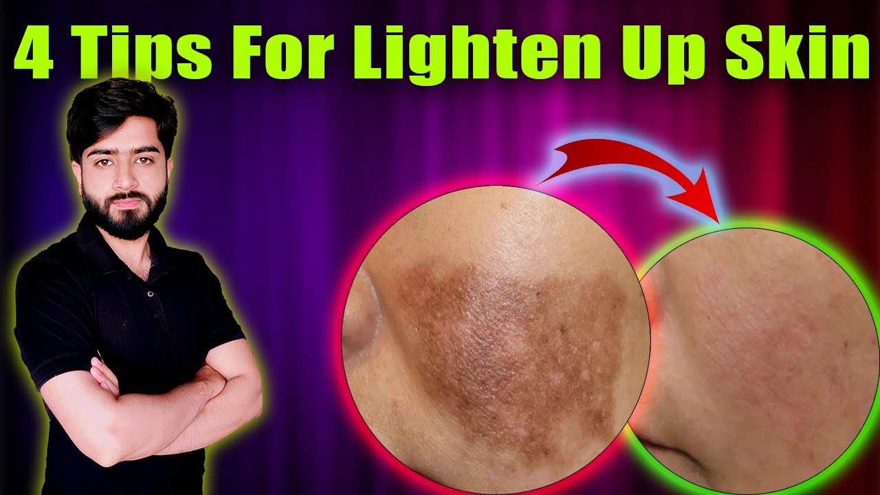4 Tips For Lighten Up Skin - Hyperpigmentation & Melasma - Anti-Pigma ...