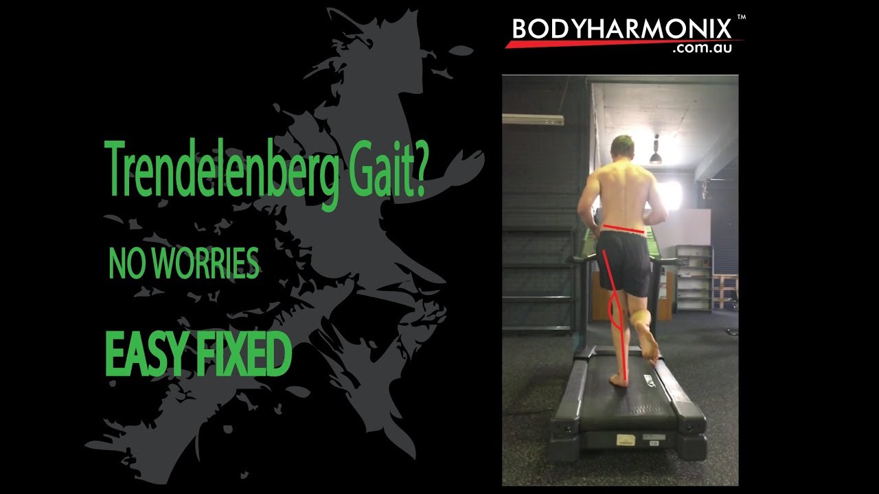 Waddling when walking? Trendelenburg Gait? - EASY FIXED (Gait Analysis ...