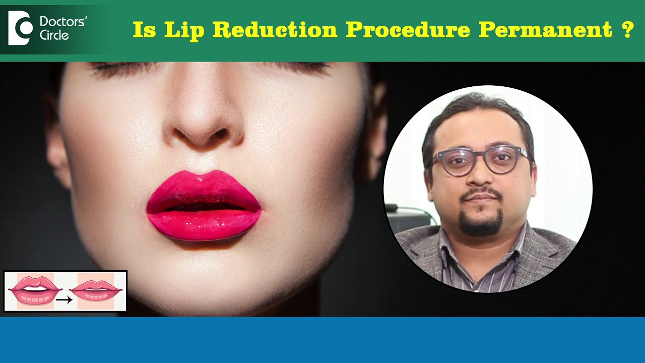 REDUCE BULKY LIPS - Is LIP REDUCTION Permanent & Recovery time -Dr ...