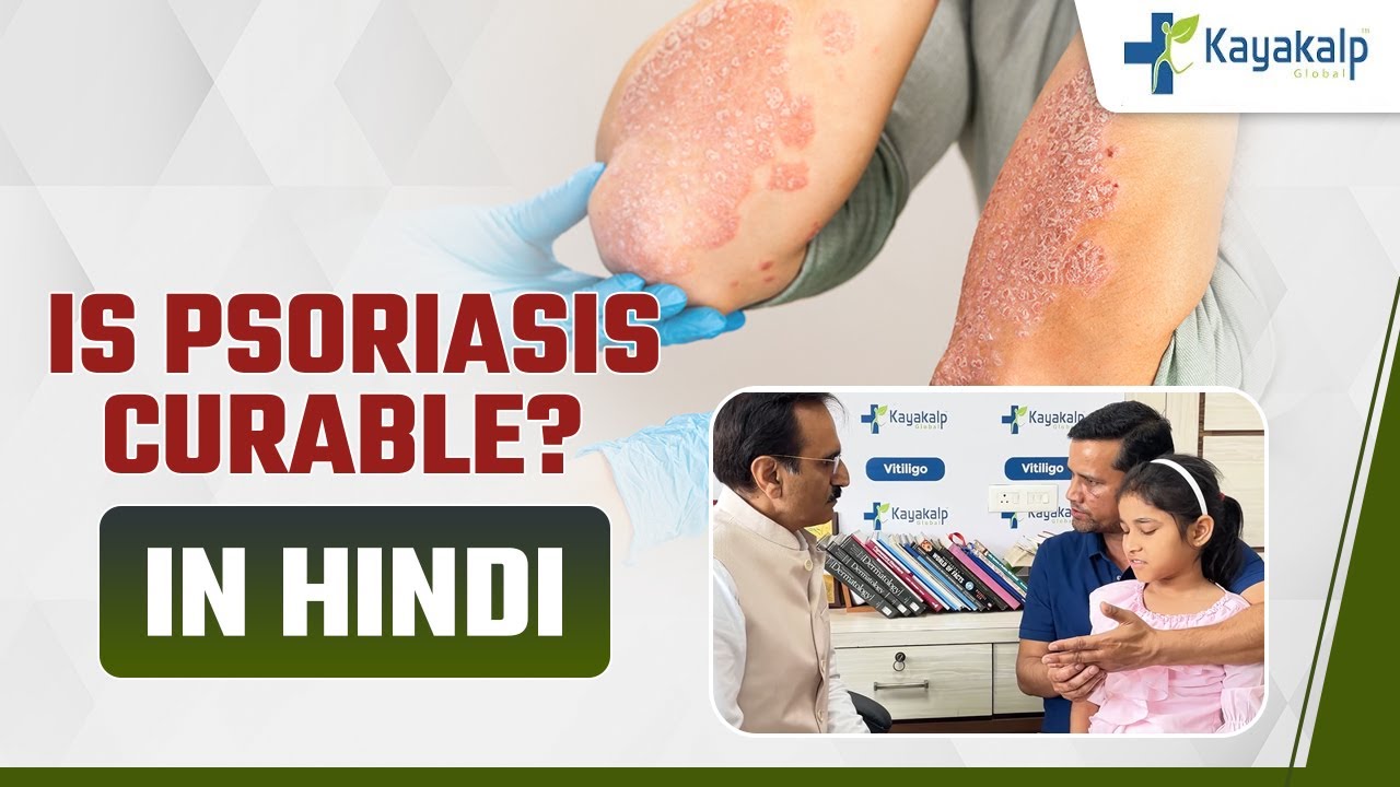 Ayurvedic Medicine से Psoriasis में आराम | OPD Treatment With Kayakalp ...