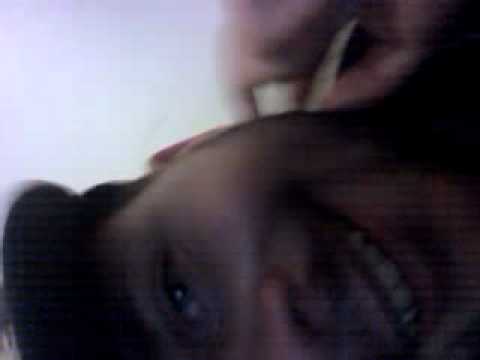 sis dose fart