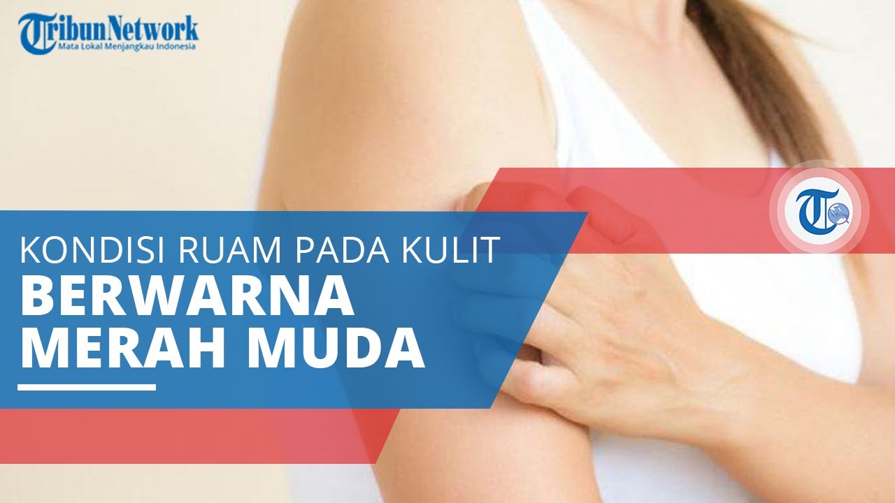 Pityriasis Rosea, Kondisi pada Kulit Tubuh yang Berupa Ruam Berwarna ...