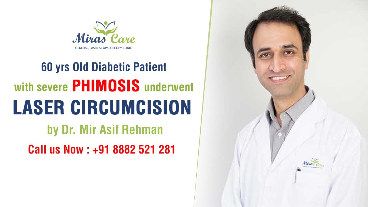 Severe Phimosis - Painless Laser Circumcision Surgery in Old Patient ...