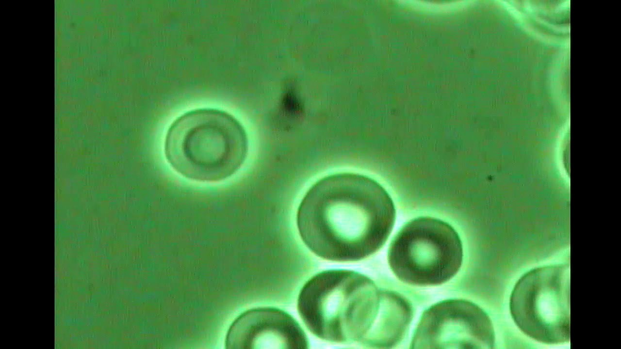 Somatide is the life energy of immortality in the blood of the human ...