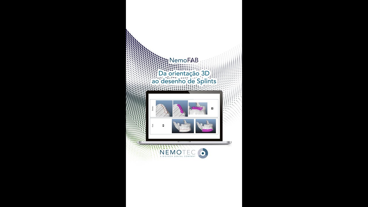 NemoFab o software completo para cirurgiões - YouTube