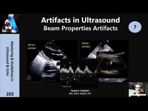 Artifacts in Ultrasound 7: Beam Properties Artifacts - YouTube