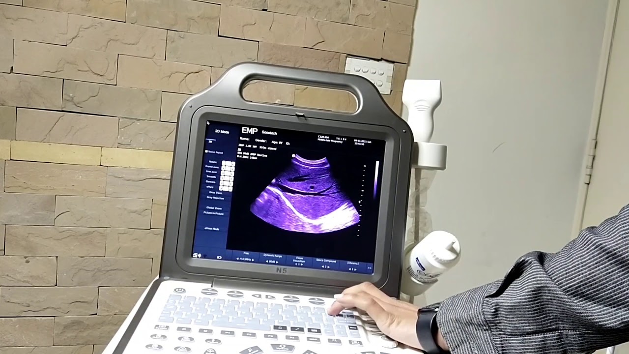 A LEADING MANUFRECTURE OF CHINA MOST SELL PRODUCT EMP N5 POWER DOPPLAR ...