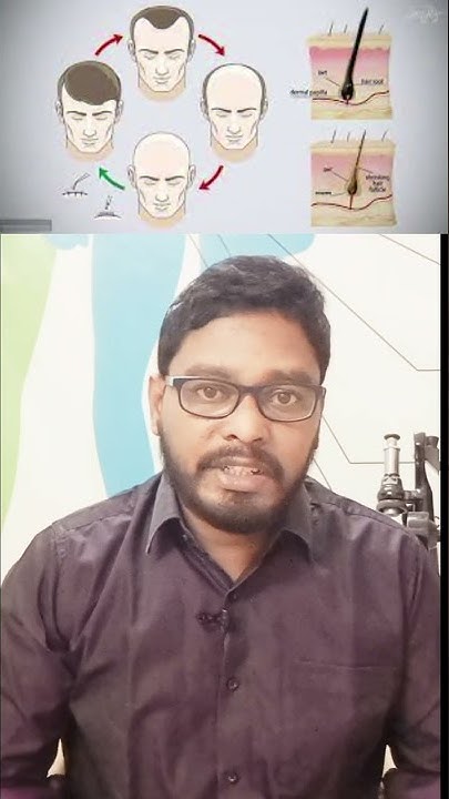 Does Masturbation Cause Hair Loss? | Stop Believing Hair Myths |சுய இன்பம் செய்தால் முடி ...