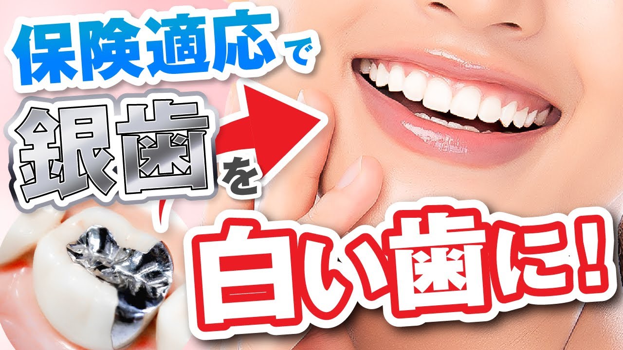 【銀歯の人必見!】歯科医が保険適用で白い歯に変える方法教えます!【歯列矯正】 Youtube