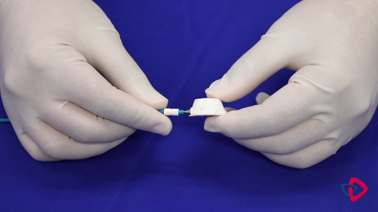 Smart Port+ and Smart Port Plastic Locking Mechanisms - YouTube