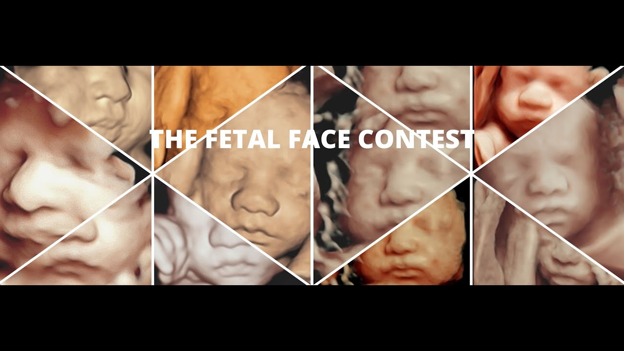 The Fetal Face Contest at Sonobuzz 2019 - YouTube
