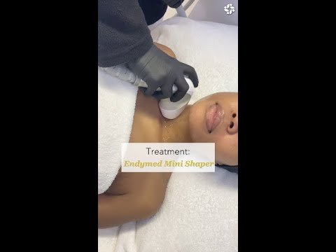 EXPERIENCE NEXT-LEVEL FIRMNESS: ENDYMED MINI SHAPER WITH 3DEEP TECHNOLOGY - YouTube