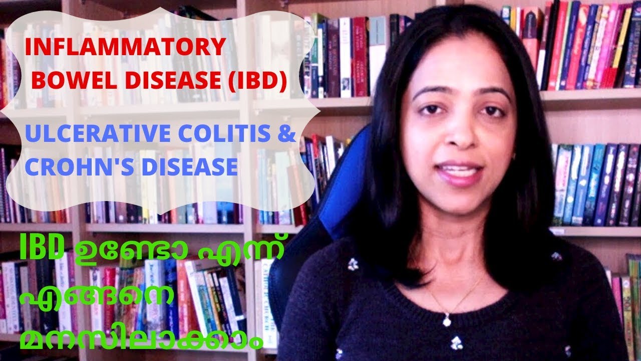 Crohn s Disease Ulcerative Colitis Infammatory Bowel Disease in crohn-s-disease-ulcerative-colitis-infammatory-bowel-disease-in