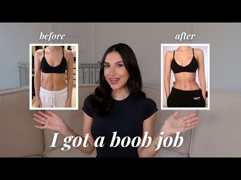My boob job experience & RESULTS! Cost, recovery, things I wish I knew...
